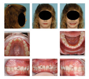 AIRWAY-kening™ Orthodontic Treatment for All Ages - Oral Health Group