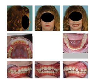 AIRWAY-kening™ Orthodontic Treatment for All Ages - Oral Health Group