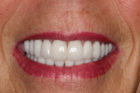 The Systematic Treatment of a Canted Smile - Oral Health Group