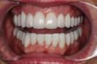 The Systematic Treatment of a Canted Smile - Oral Health Group