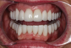 The Systematic Treatment of a Canted Smile - Oral Health Group