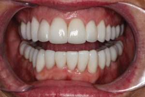The Systematic Treatment of a Canted Smile - Oral Health Group