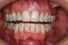 The Systematic Treatment of a Canted Smile - Oral Health Group