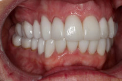 The Systematic Treatment of a Canted Smile - Oral Health Group