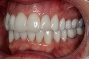 The Systematic Treatment of a Canted Smile - Oral Health Group