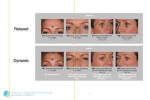 Botulinum Toxin: Not Just a Pretty Face - Oral Health Group