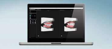 New Carestream Dental Software Redefines Orthodontic Workflow - Oral ...