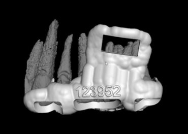 The Cortical Window: Part Two Computer Guided Endodontic Surgery (CGES)