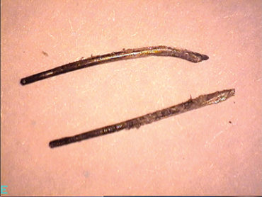 Product Profile: GentleWave® System - Oral Health Group