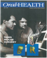 Wisdom Tooth Removal: 25 Years Smarter? - Oral Health Group