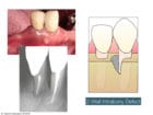 Improved Long-Term Treatment Outcomes of Teeth with Deep Pockets and ...
