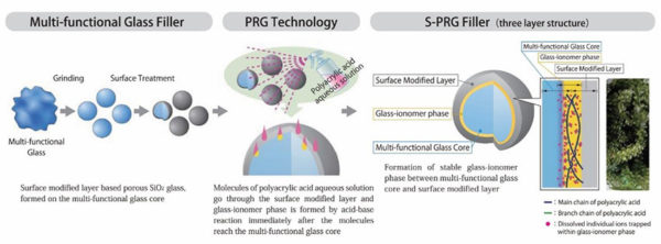 生物活性Giomer材料可以帮助改善临床结果-口腔健康集团
