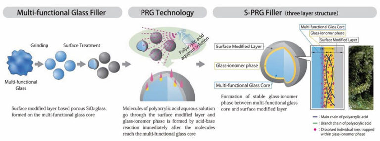 Bioactive Giomer Materials Can Help Improve Clinical Outcomes - Oral ...
