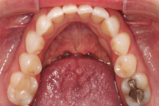 Minimally Invasive Smile Rejuvenation - Oral Health Group