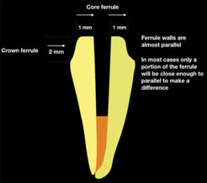 The Endodontic Restorative Harmonic: Part I Access To Apex, Apex To ...