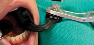 Dental Implant Surgery With Robotic Guidance - Oral Health Group