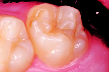 Technology In Minimally Invasive Dentistry - Oral Health Group