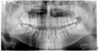 Maxillofacial Hardware: A Review Of Techniques - Oral Health Group