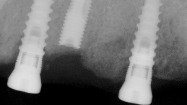 August 2019 Archives - Oral Health Group