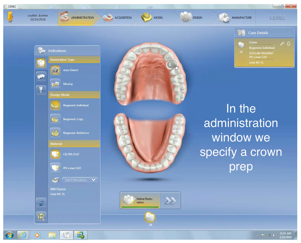A Digital Workflow For Guided Implant Surgery Using CEREC Guide 2