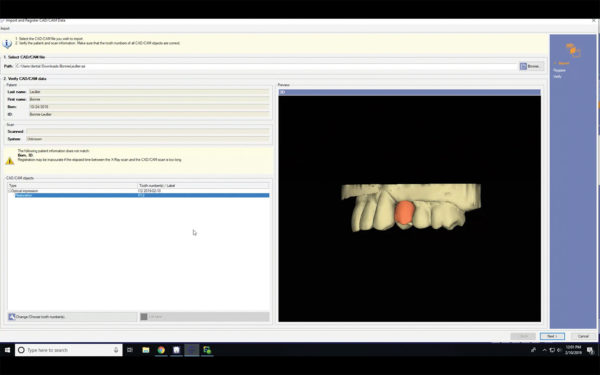 A Digital Workflow For Guided Implant Surgery Using CEREC Guide 2