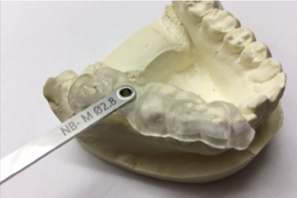Rihal-sample-of-medium-size-key-sets-for-nobel-implants - Oral Health Group