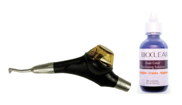 Treating The Black Triange With The Bioclear Method - Oral Health Group