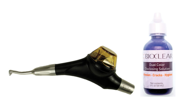 Treating The Black Triange With The Bioclear Method - Oral Health Group