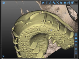 Guided Implantology: The SMART Guide - Oral Health Group