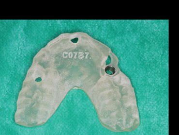 Guided Implantology: The SMART Guide - Oral Health Group