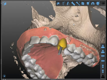 Guided Implantology: The SMART Guide - Oral Health Group