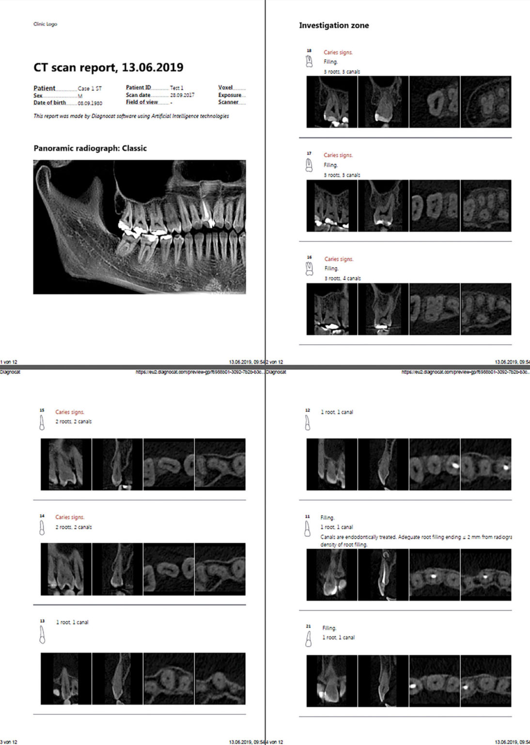 Artificial Intelligence and Deep Learning in Dental Radiology