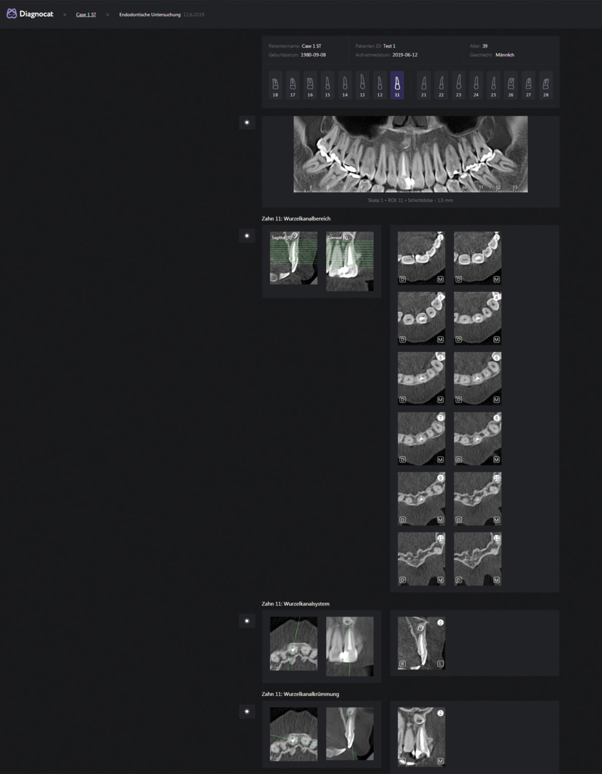 Artificial Intelligence and Deep Learning in Dental Radiology