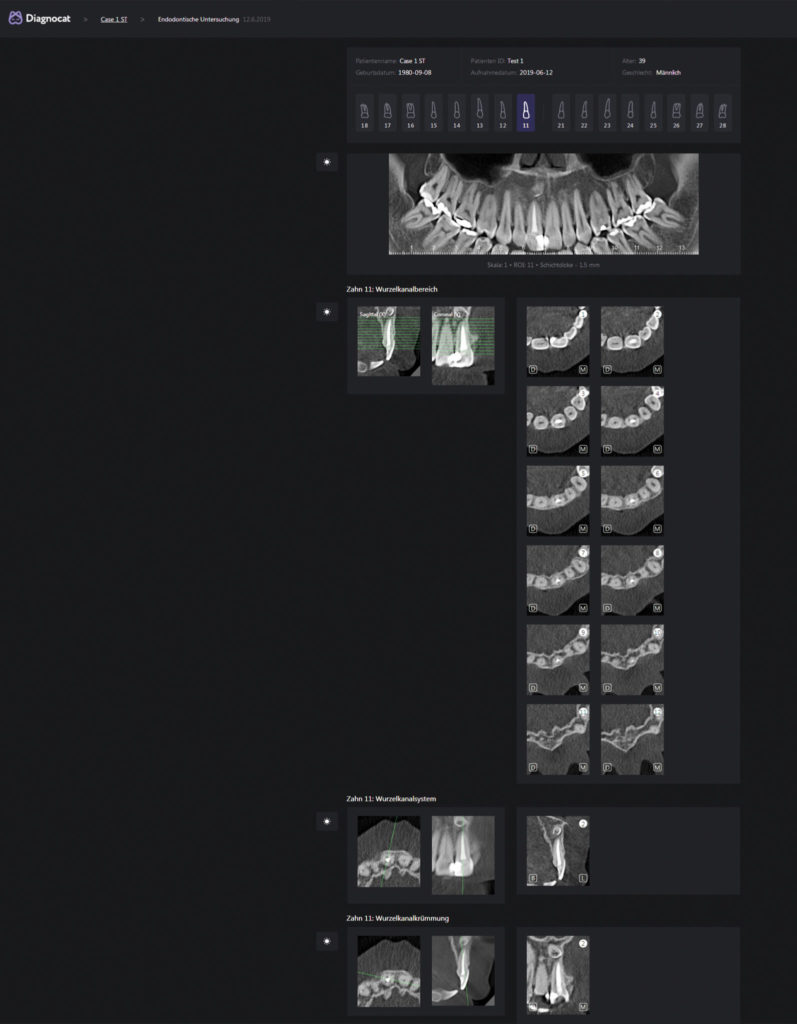 Artificial Intelligence and Deep Learning in Dental Radiology