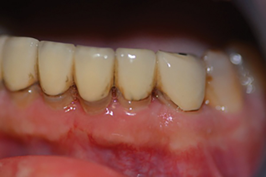 Desai-fig-7c - Oral Health Group