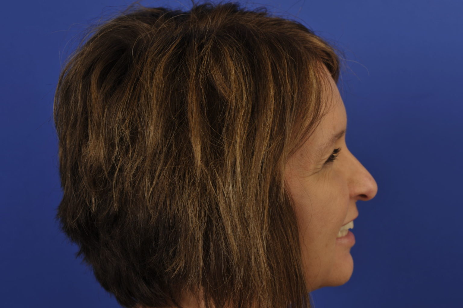 Photography Essentials in Dentistry - Oral Health Group