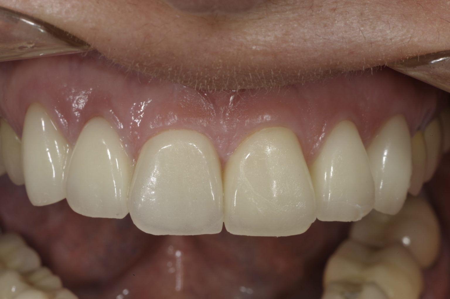 Photography Essentials in Dentistry - Oral Health Group