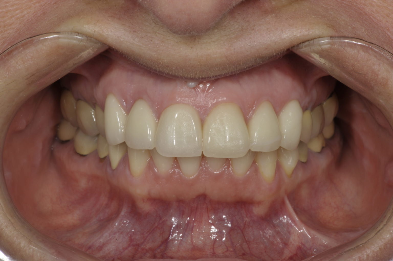 Photography Essentials in Dentistry - Oral Health Group