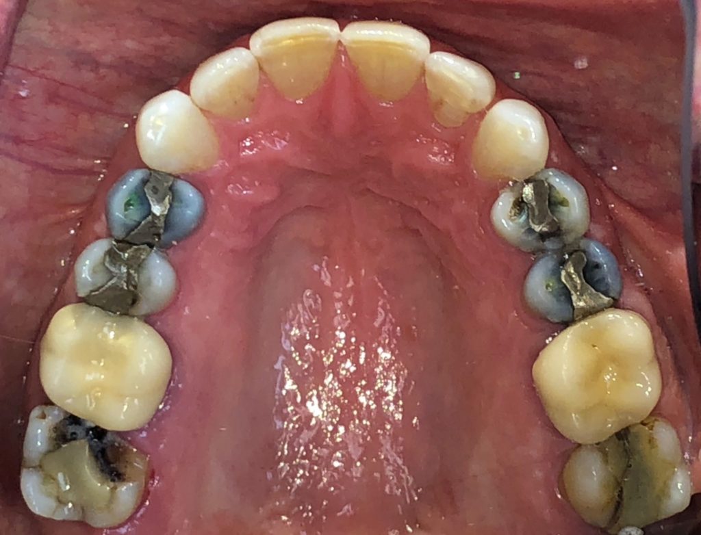 Are You Saving Lives or Saving Teeth? - Oral Health Group