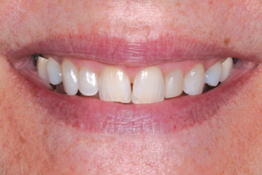 Principles of Smile Design Treatment Planning - Oral Health Group