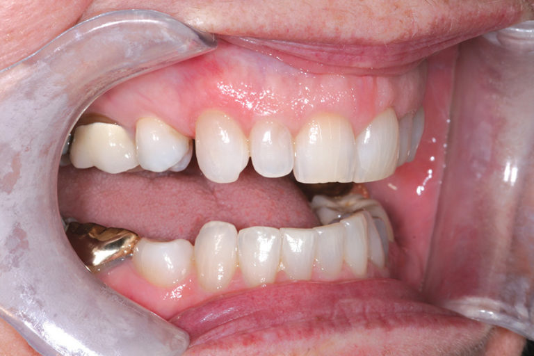 Principles of Smile Design Treatment Planning - Oral Health Group