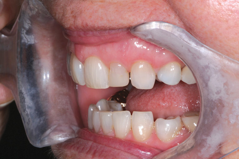 Principles of Smile Design Treatment Planning - Oral Health Group