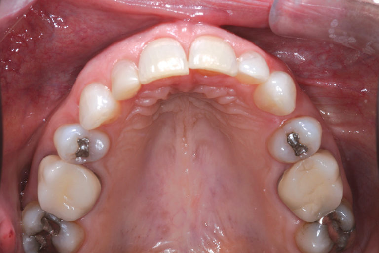 Principles of Smile Design Treatment Planning - Oral Health Group