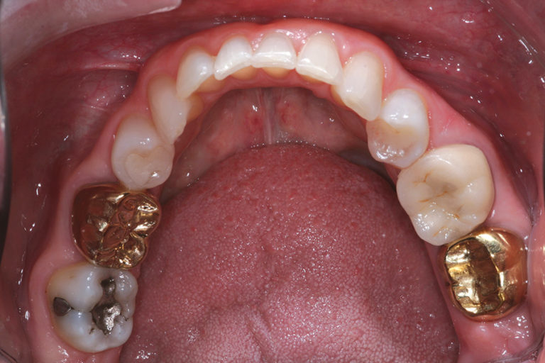 Principles of Smile Design Treatment Planning - Oral Health Group