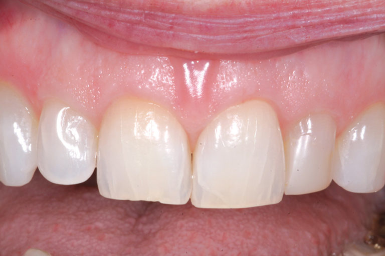 Principles of Smile Design Treatment Planning - Oral Health Group