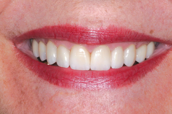 Principles of Smile Design Treatment Planning - Oral Health Group