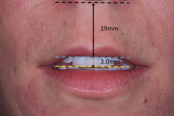 Principles of Smile Design Treatment Planning - Oral Health Group