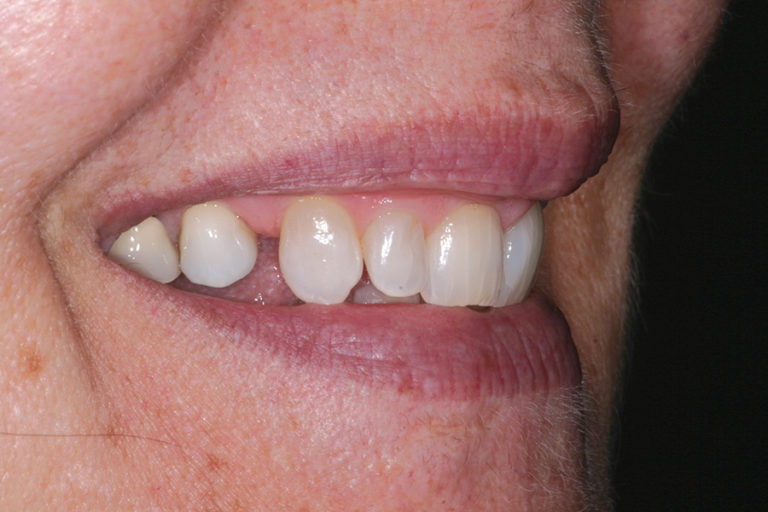 Principles of Smile Design Treatment Planning - Oral Health Group