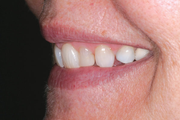 Principles of Smile Design Treatment Planning - Oral Health Group