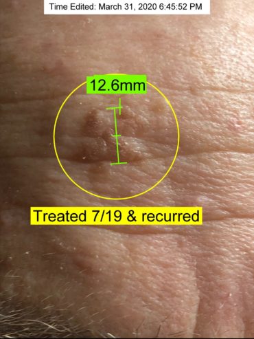 Socially Distanced Dentistry - Oral Health Group